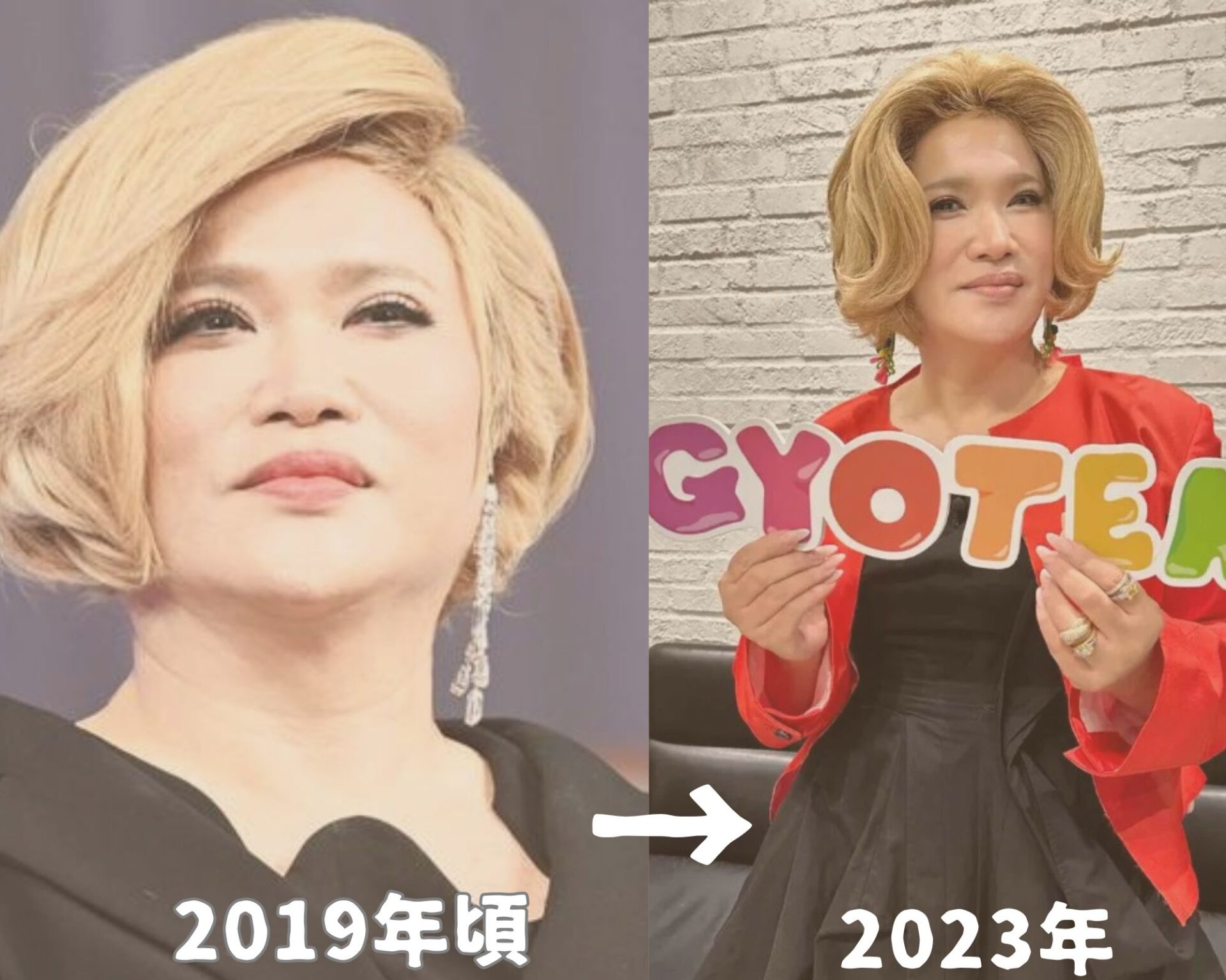 【画像】IKKO激やせはなぜ？理由は病気？比較検証してみた(仰天ニュース)